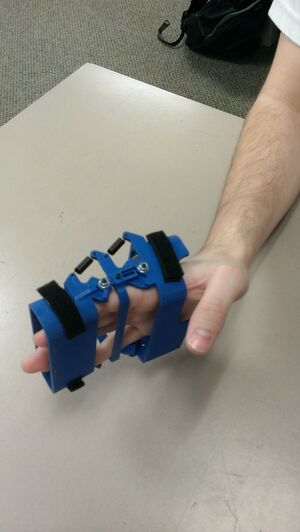 Robotic Arm Assist - Mindworks